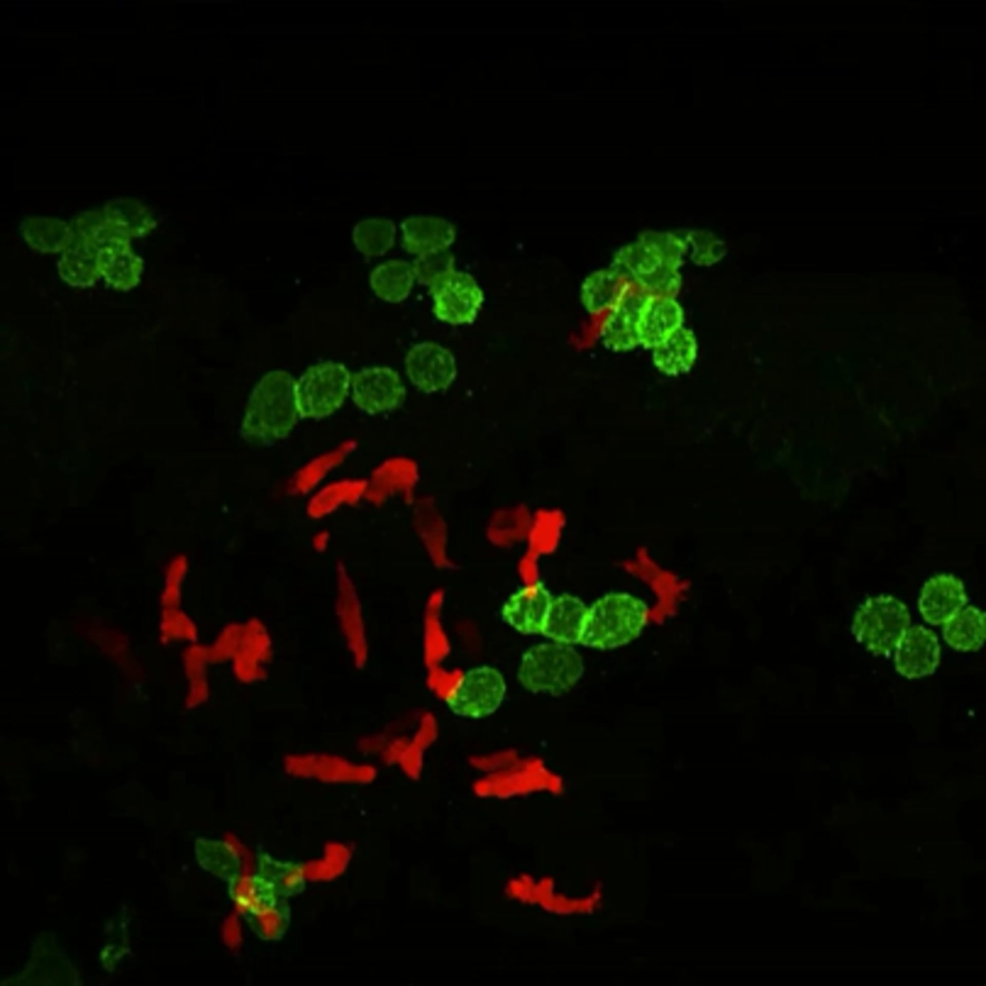 Confocal laser-scanning microscopy shows how wound healing influences ...