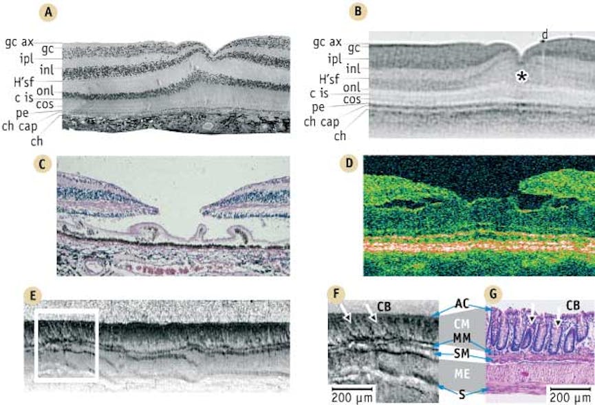 OCT imaging leaps to the next generation | Laser Focus World