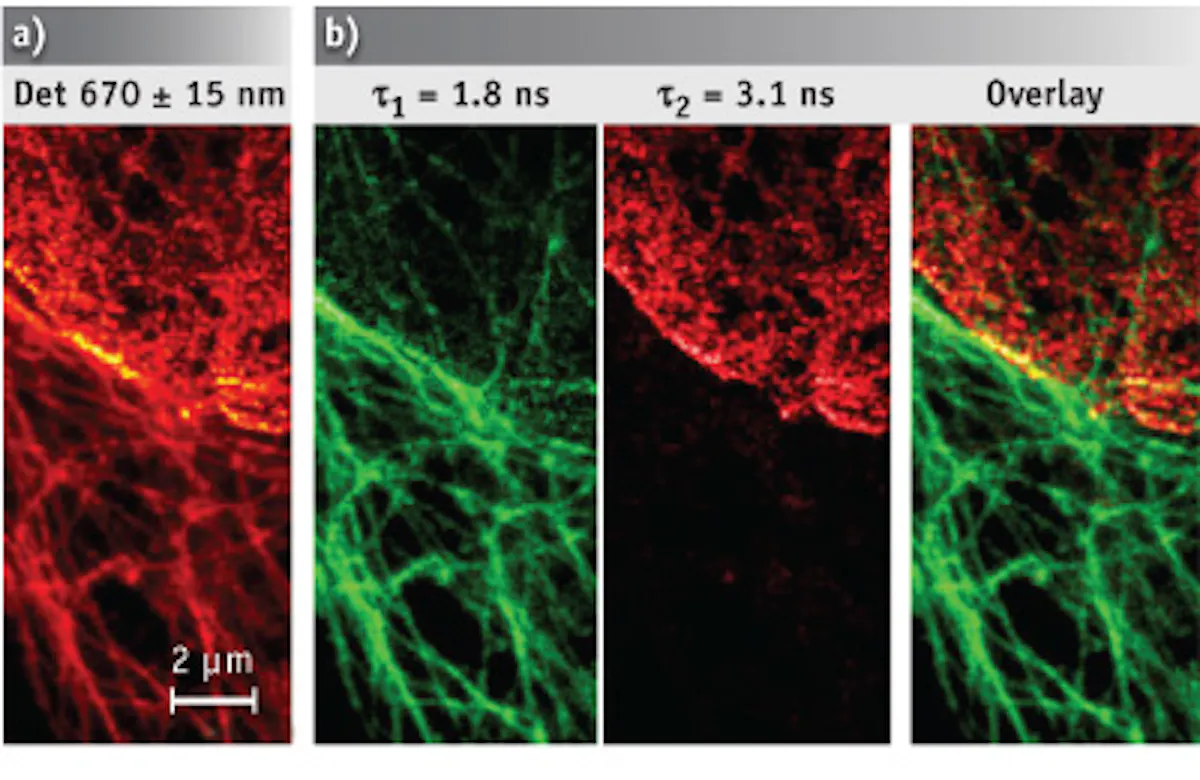 MICROSCOPY/LIVE CELL IMAGING/CELL BIOLOGY: First STED imaging of live ...
