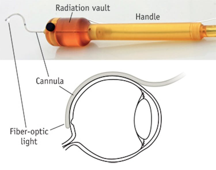 OPHTHALMOLOGY/NONINVASIVE TREATMENT: Fiber-optic device promises ...