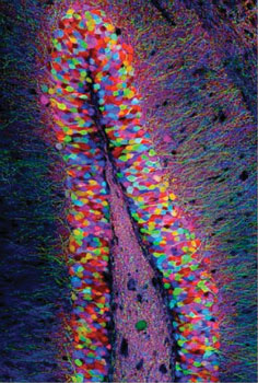 OPTOGENETICS/NEUROSCIENCE: Light triggering demonstrates that memory ...