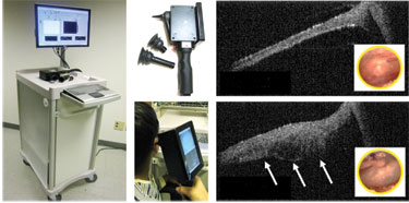 OPTICAL COHERENCE TOMOGRAPHY/GENERAL MEDICINE: Low-cost OCT probe ...