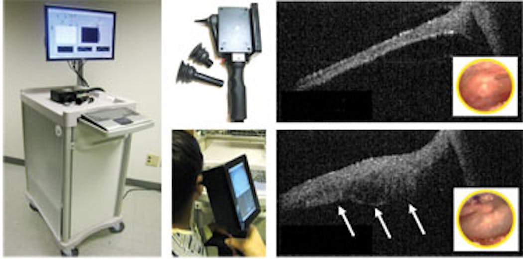OPTICAL COHERENCE TOMOGRAPHY/GENERAL MEDICINE: Low-cost OCT probe ...
