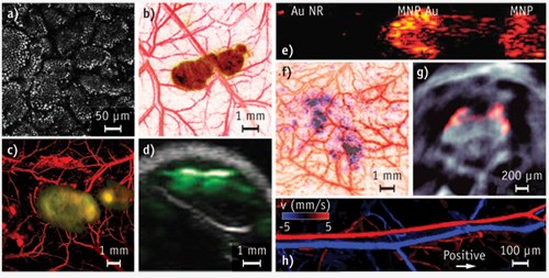 OPTOACOUSTICS/DEEP TISSUE IMAGING: Photoacoustic tomography is ready to revolutionize | Laser ...