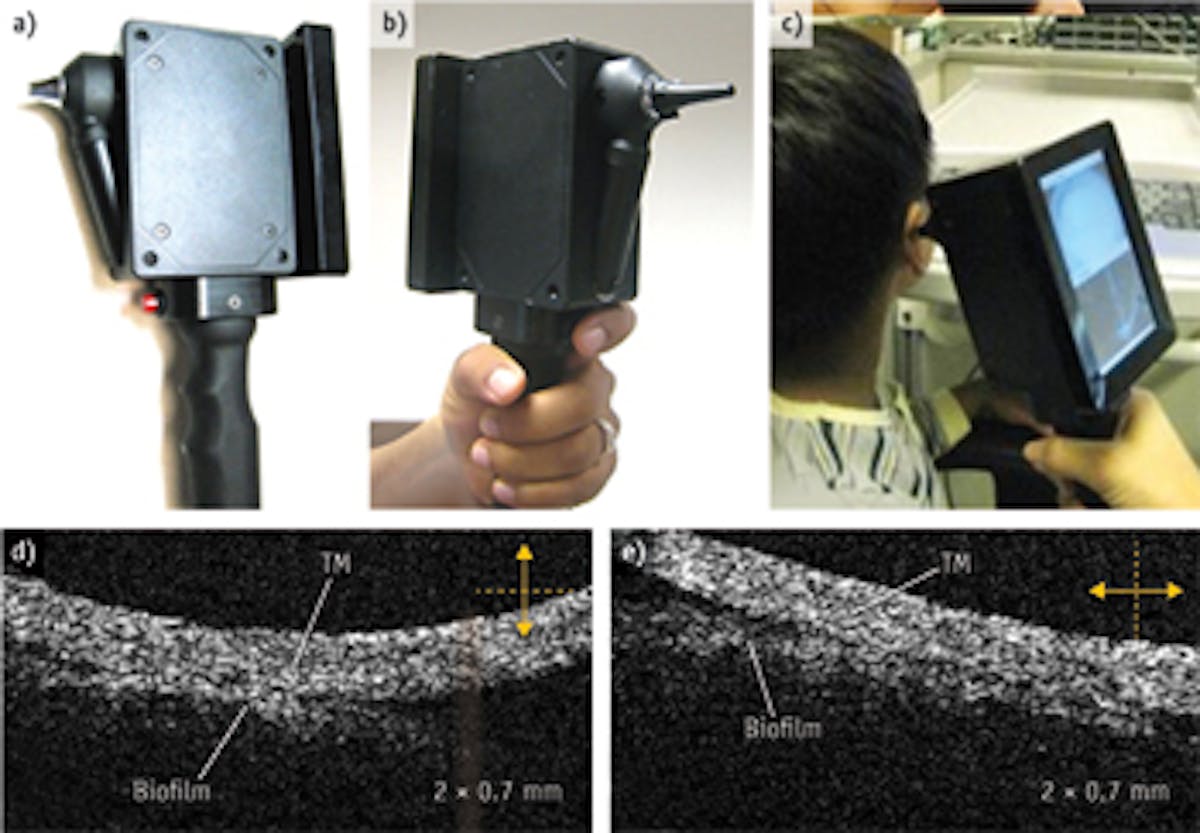 NEAR-INFRARED OPTICS/OCT/ONCOLOGY: Handheld optical devices for the ...