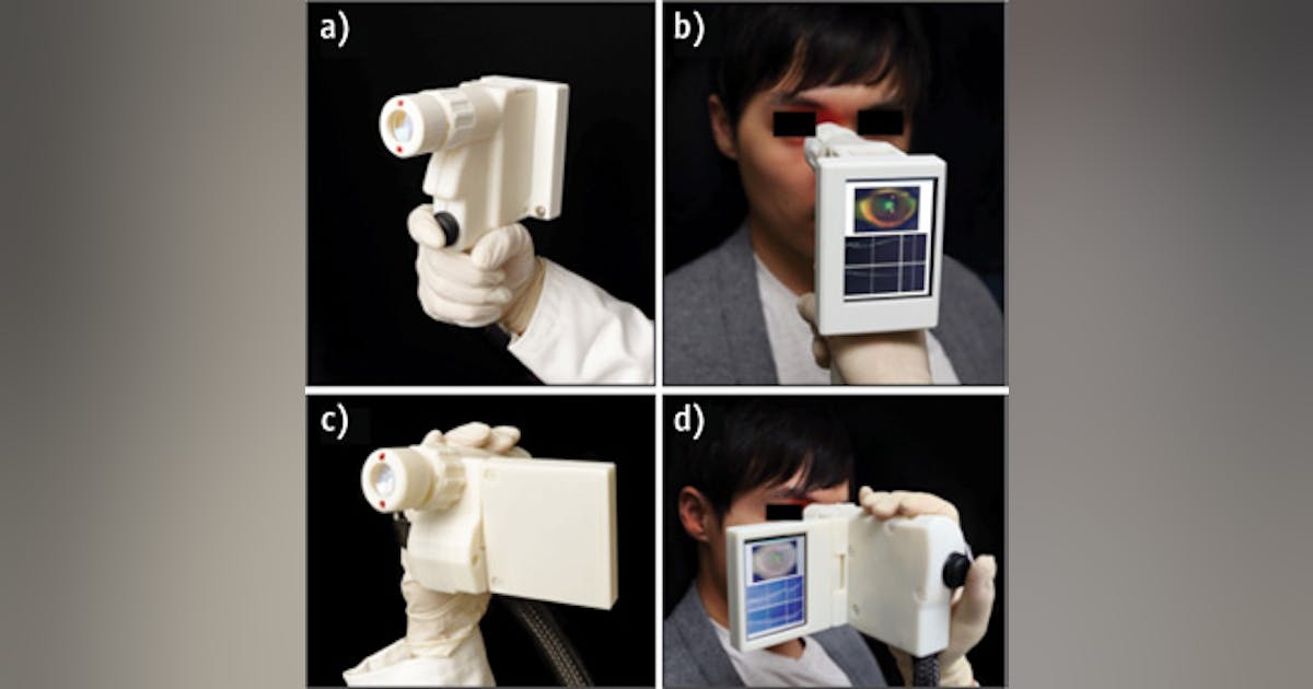 Primary Care Screeningoctdisease Detection Handheld Oct Device Promises Screening For Retinal