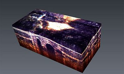 Spectroscopic OCT technique reveals true colors of living tissue ...