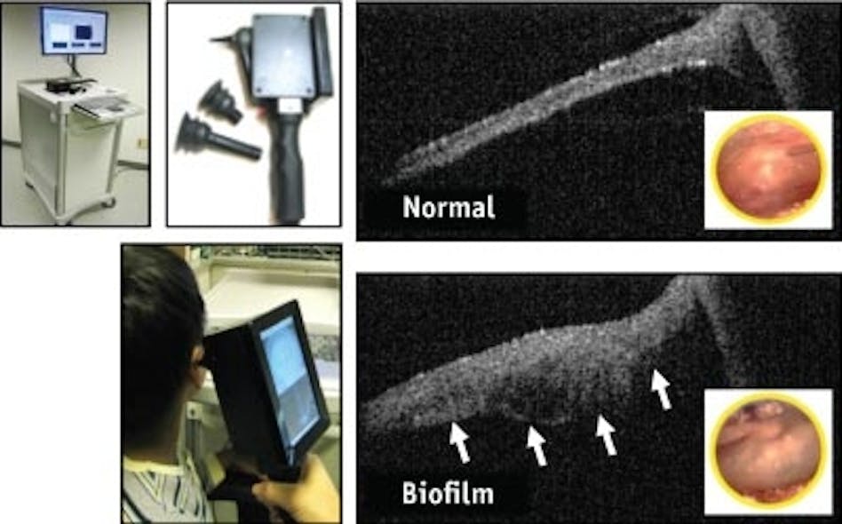 Researchers develop handheld OCT device for primary care physician use ...