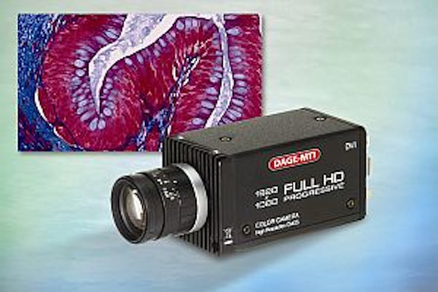 HD CMOS camera for microscopy by Dage-MTI | Laser Focus World