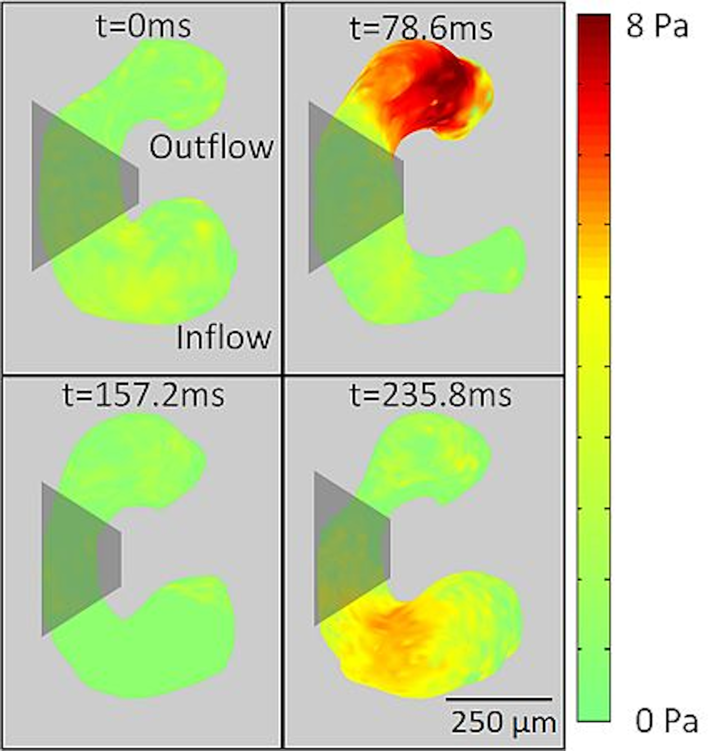 Doppler OCT imaging sheds light on health of baby's heart | Laser Focus ...