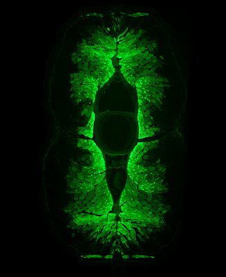 New fluorescent protein from eel revolutionizes clinical biomarker ...