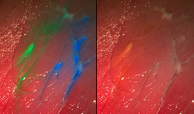 Multispectral fluorescence camera detects tumors | Laser Focus World