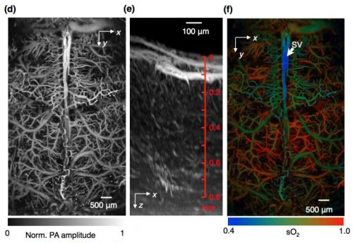 Photoacoustic microscopy images functions in the living brain quickly ...