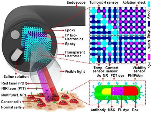 Multifunctional endoscope could treat, remove cancer cells in minimally ...