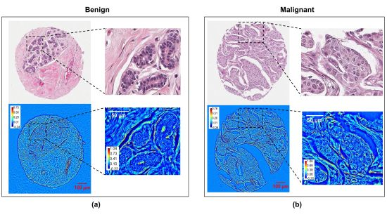 Label-free microscopy method is promising for more accurate cancer ...