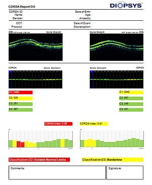 Diopsys software boosts spectral-domain optical coherence tomography ...