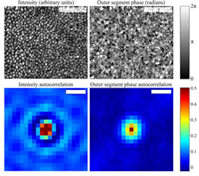 OCT tracks growth and shrinkage of cone-cell appendages in living human ...