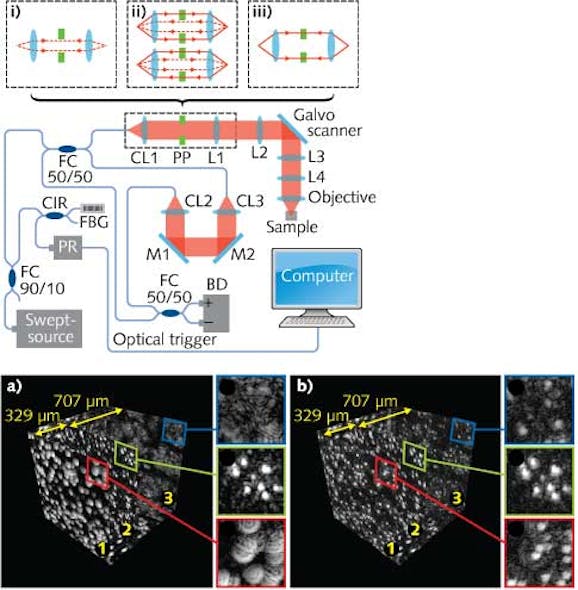 Optical Coherence Tomography: Synthetic aperture OCT extends focal ...