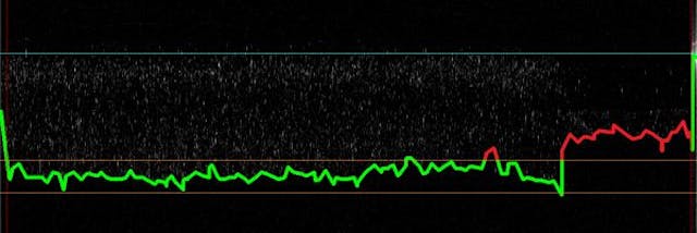 Direct measurement of laser weld depth with inline coherent imaging ...