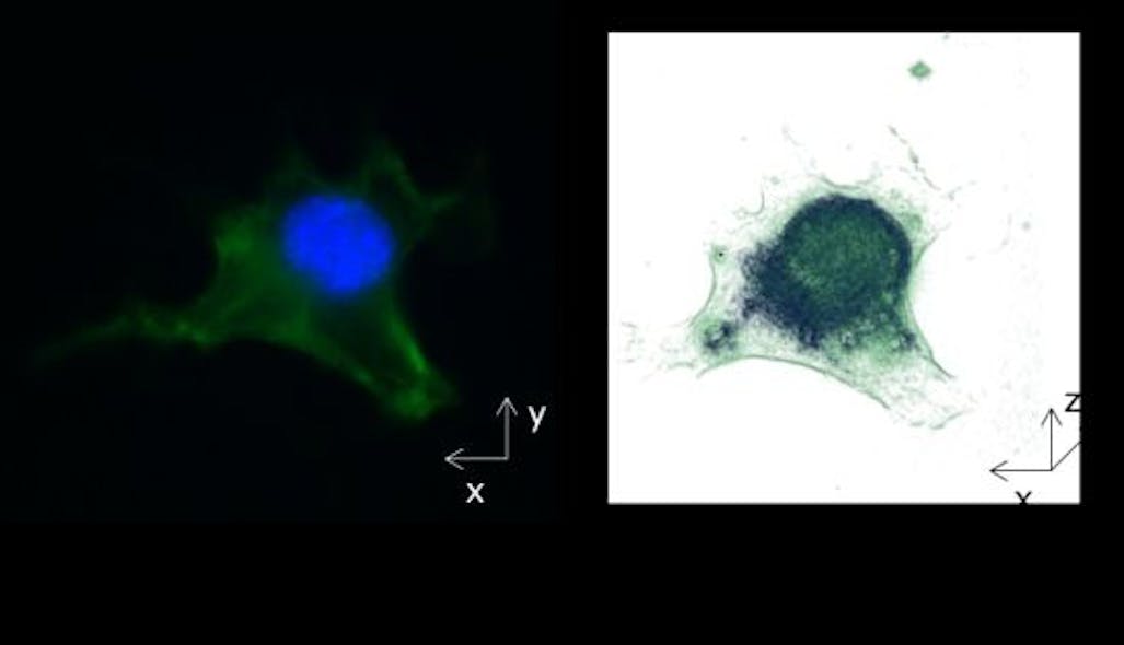 Super-res microscope explores living cells in 3D noninvasively | Laser ...