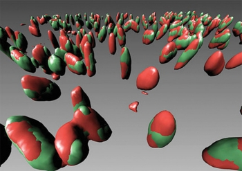 PATHOGEN DETECTION/FOOD SAFETY: IR spectroscopy speeds E. coli ...