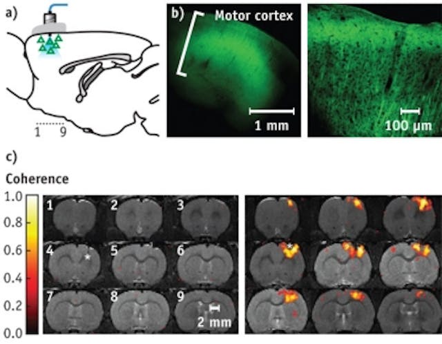 NEUROLOGY/LIGHT-TISSUE INTERACTION: In-vivo precision targeting with ...
