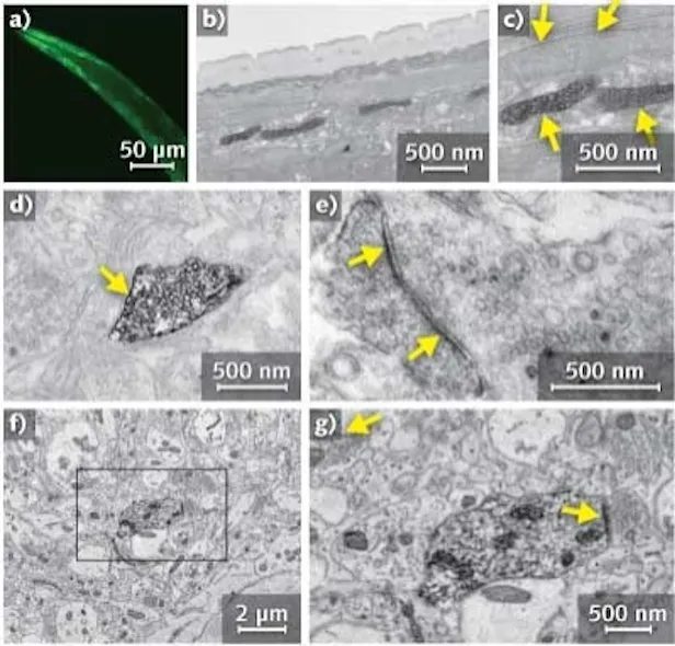 MICROSCOPY: Light-absorbing engineered protein improves usefulness of ...
