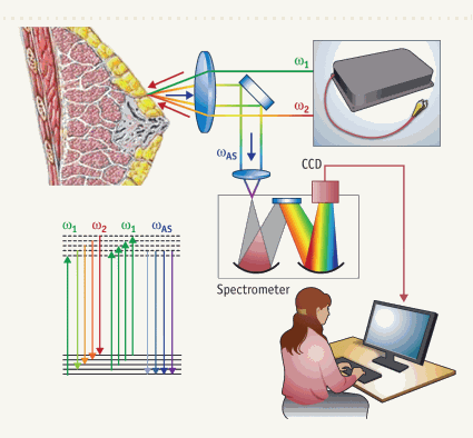 SPECTROSCOPY/MICROSCOPY: Nonlinear Raman microscopy eyes clinical ...