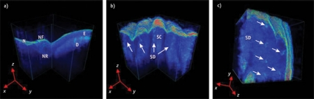 SURGICAL GUIDANCE/ULTRA HIGH-SPEED PROCESSING: The next step in real ...