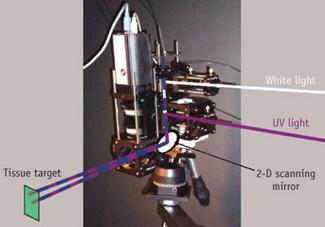 Imaging technologies take charge in the war on cancer | Laser Focus World