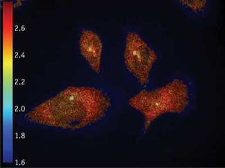 ‘Fast FLIM’ speeds imaging of fluorescence lifetime | Laser Focus World