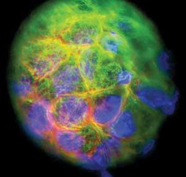 CELL BIOLOGY : Light-sheet microscopes reveal cells in action | Laser ...