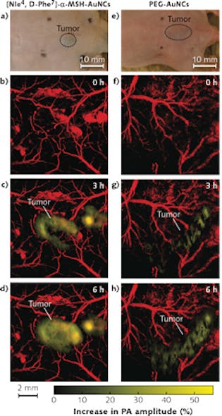 Photoacoustics/Biomedical Imaging: Photoacoustic imaging progresses ...