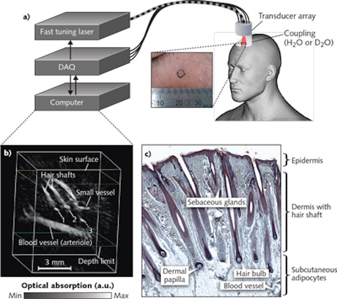 Photoacoustics/Biomedical Imaging: Photoacoustic imaging progresses ...