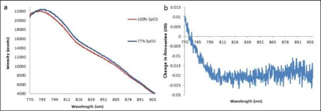 Near-infrared spectroscopy aids in neonatal brain injury diagnosis ...