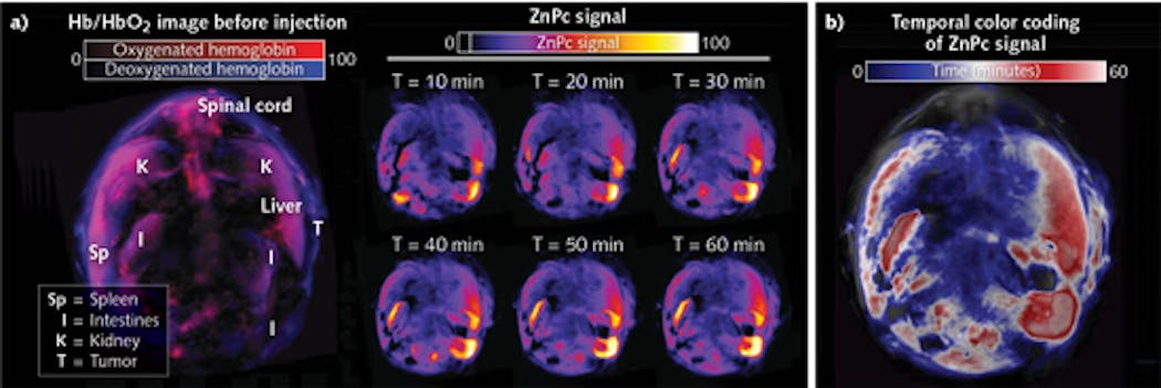 Photoacoustics/Biomedical Imaging: Photoacoustic imaging progresses ...
