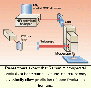 Raman studies may help predict bone fracture | Laser Focus World