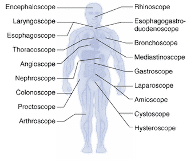 Microendoscopy takes diagnostics deeper into the body | Laser Focus World
