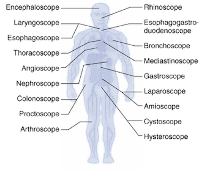 Microendoscopy takes diagnostics deeper into the body | Laser Focus World