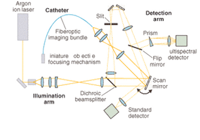 Microendoscopy takes diagnostics deeper into the body | Laser Focus World