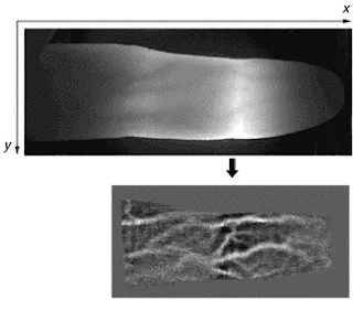Finger vein patterns used for identification | Laser Focus World
