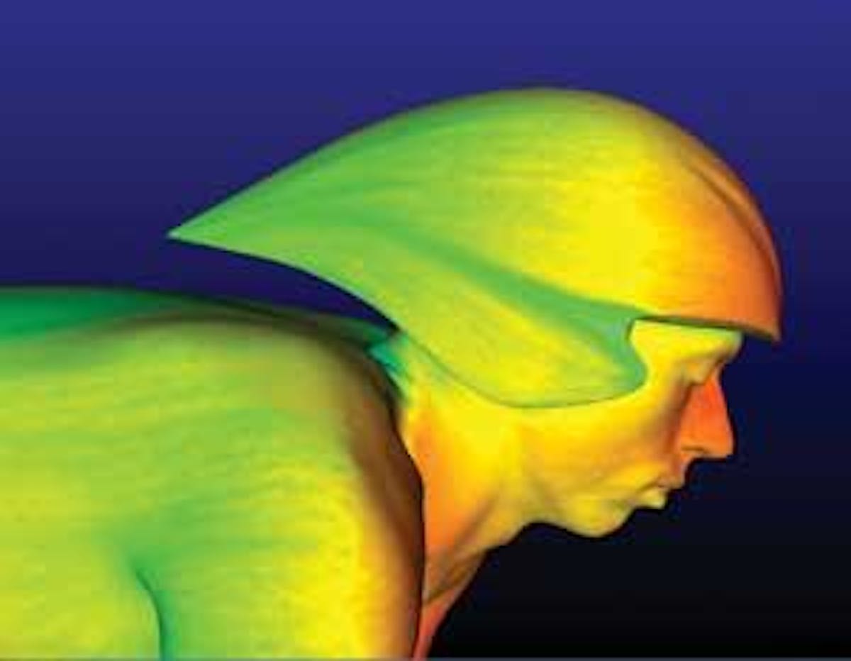 THREE-DIMENSIONAL IMAGING: Laser scanner helps Olympic win | Laser ...
