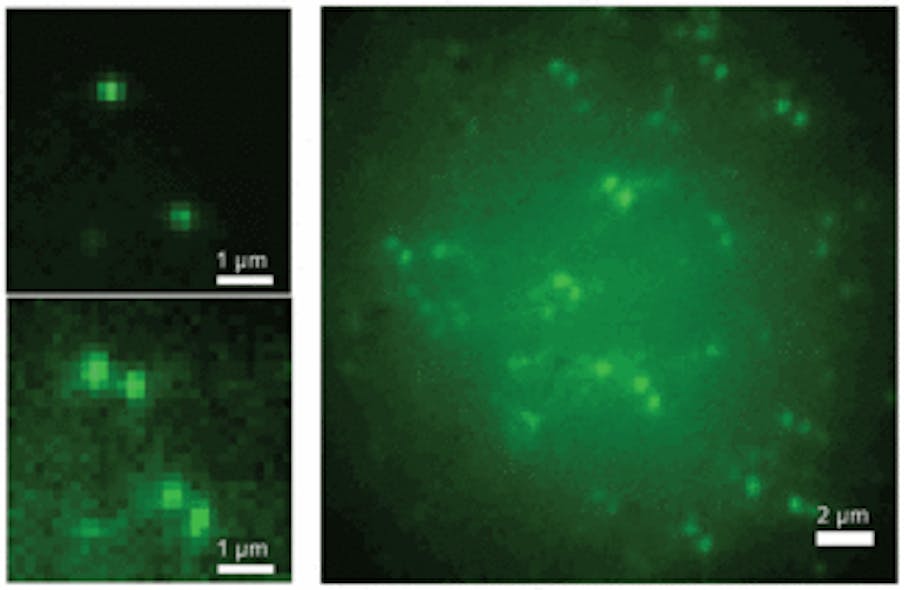 Double helix-PSF enables superresolution 3-D imaging | Laser Focus World