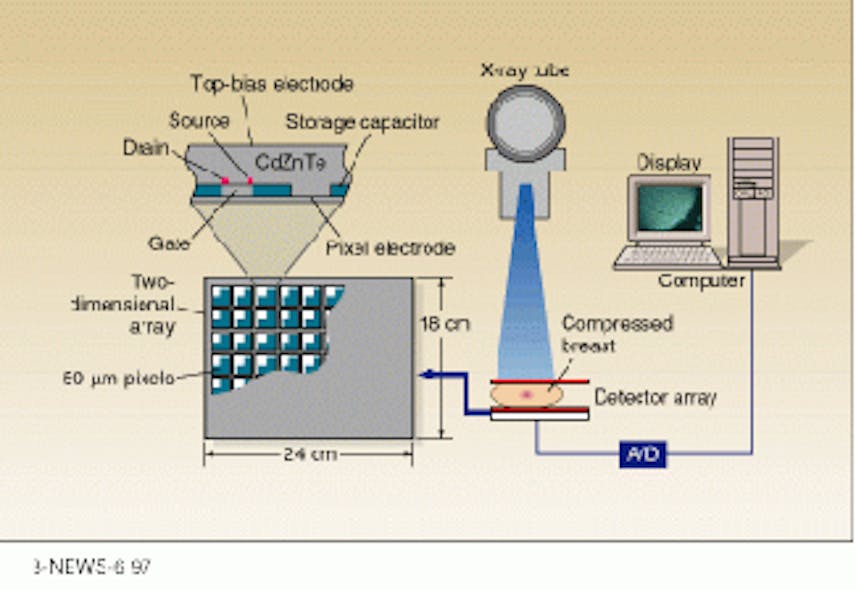 Thin-film arrays may improve mammography | Laser Focus World