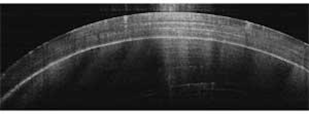 OPTICAL COHERENCE TOMOGRAPHY: OCT aims for industrial application ...