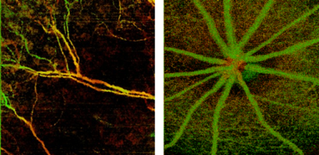 Wasatch Photonics unveils OCT angiography technique | Laser Focus World