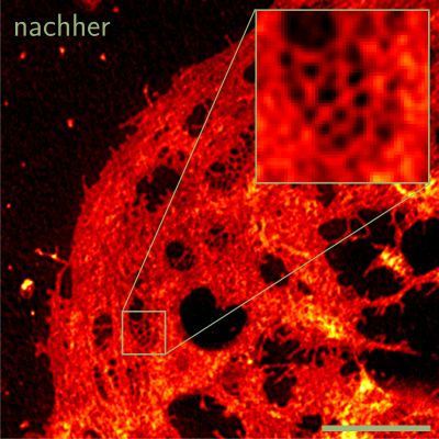 Researchers develop open source software for high-resolution microscopy ...
