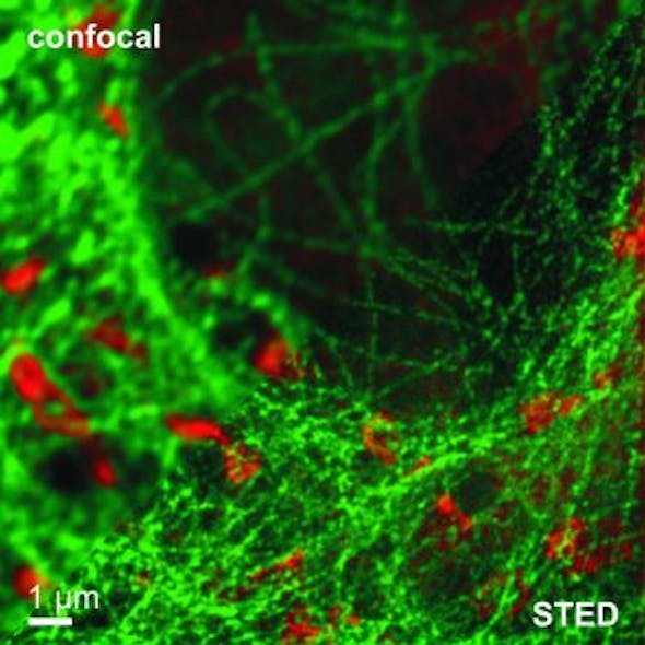 Fluorescence imaging method visualizes nine structures in one ...