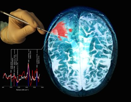 Multimodal optical spectroscopy probe detects multiple types of cancer ...