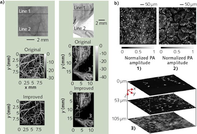 Photoacoustics/Microscopy/Bioimaging: Photoacoustic microscopy enters ...